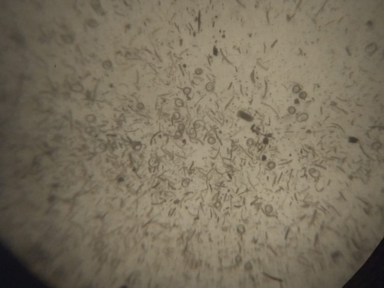 Acciones sanitarias por triquinosis en un establecimiento porcino de ...